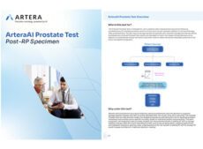 ArteraAI Prostate Test (Post RP) | ArteraAI